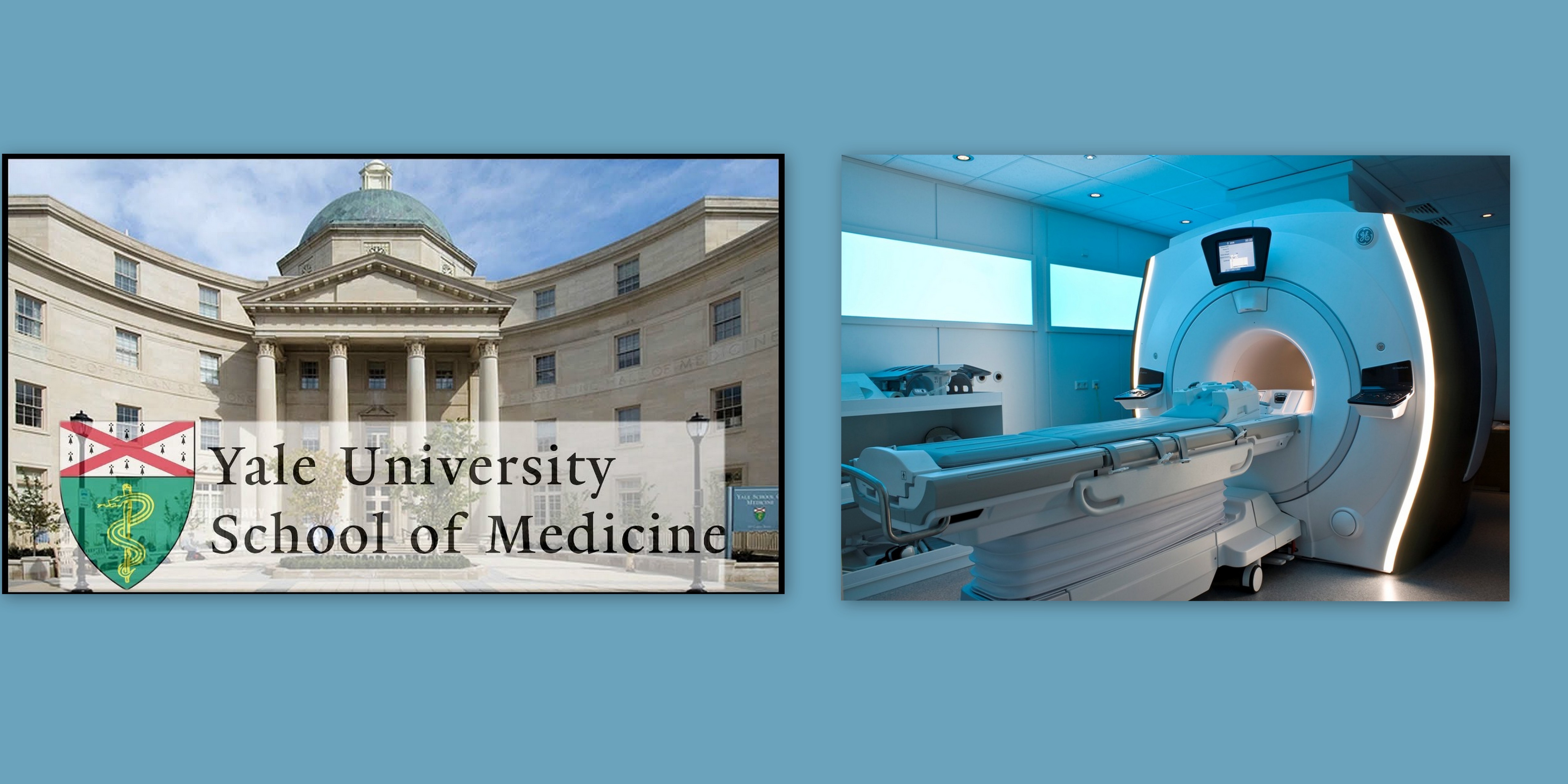 YALE UNIVERSITY STANDARDS AND TRAINED PERSONNEL MAKE ST.KITTS MRI ...